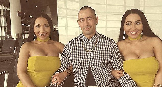 Worlds ‘most Identical Twins Spend 250k On Plastic Surgeries To Look Even More Alike Small Joys