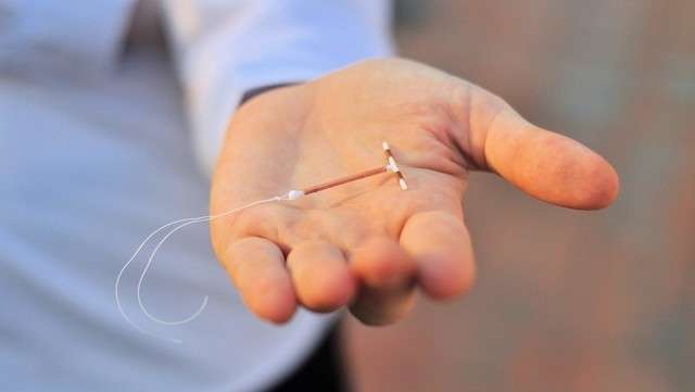 Increíble Imagen De Un Bebé Que Nació Junto Al DIU Que Usaba Su Madre ...