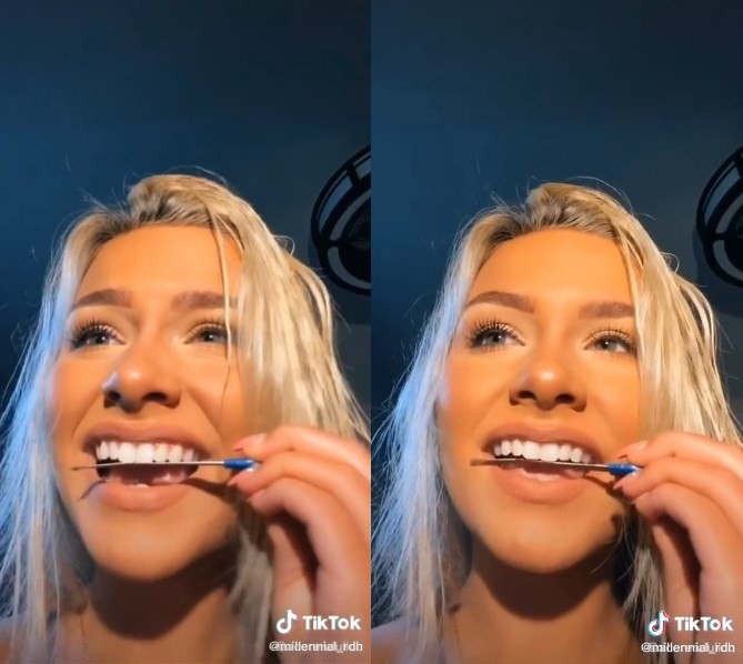 TikTok Users Are Seen Grinding Down Their Teeth With Nail Files To Achieve A Symmetrical Smile ...