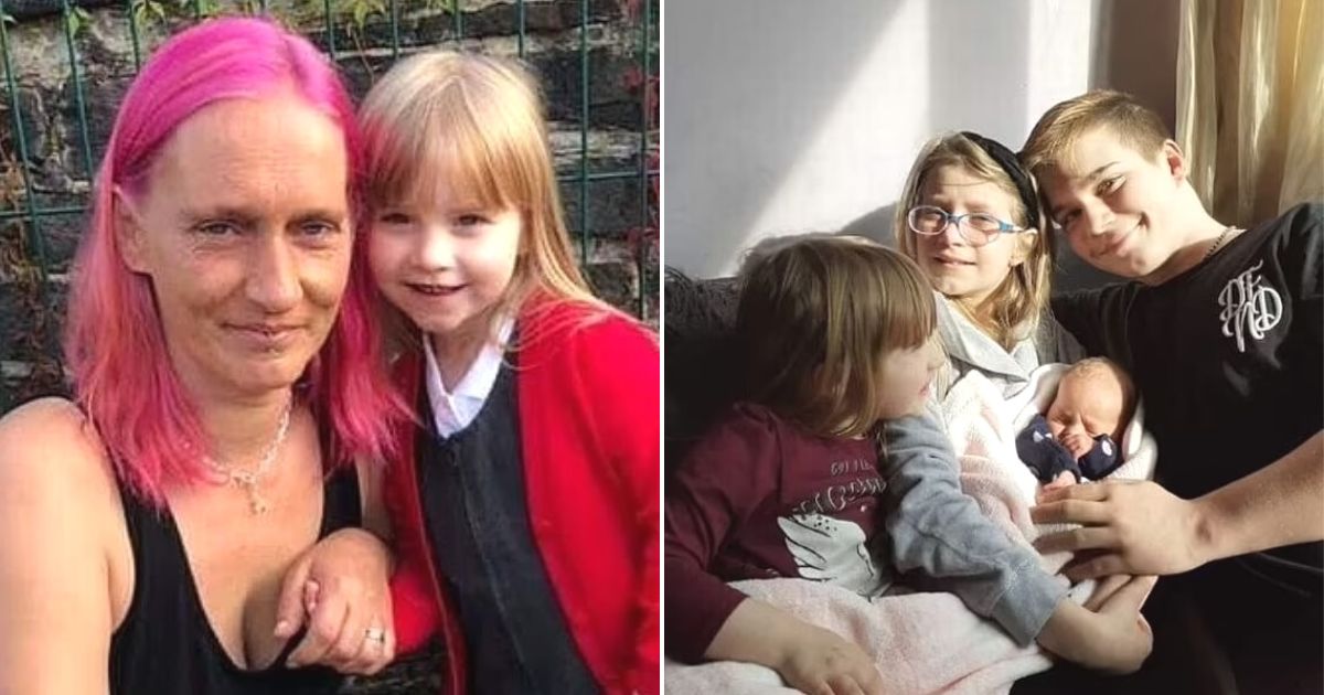 Pupula Duplex | Everything You Need To Know About The Rare Double Pupil Condition